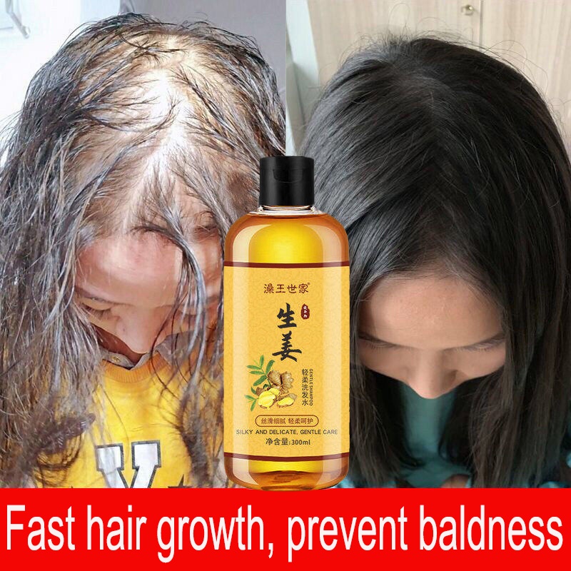 Anti-Hair Loss Shampoo Oil Control Anti-Dandruff Anti-Hair Loss Improve ...