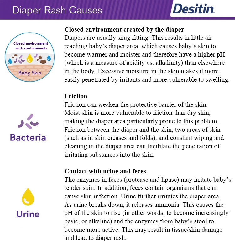 Desitin Maximum Strength Original Diaper Rash Paste Baby Cream/ Daily ...