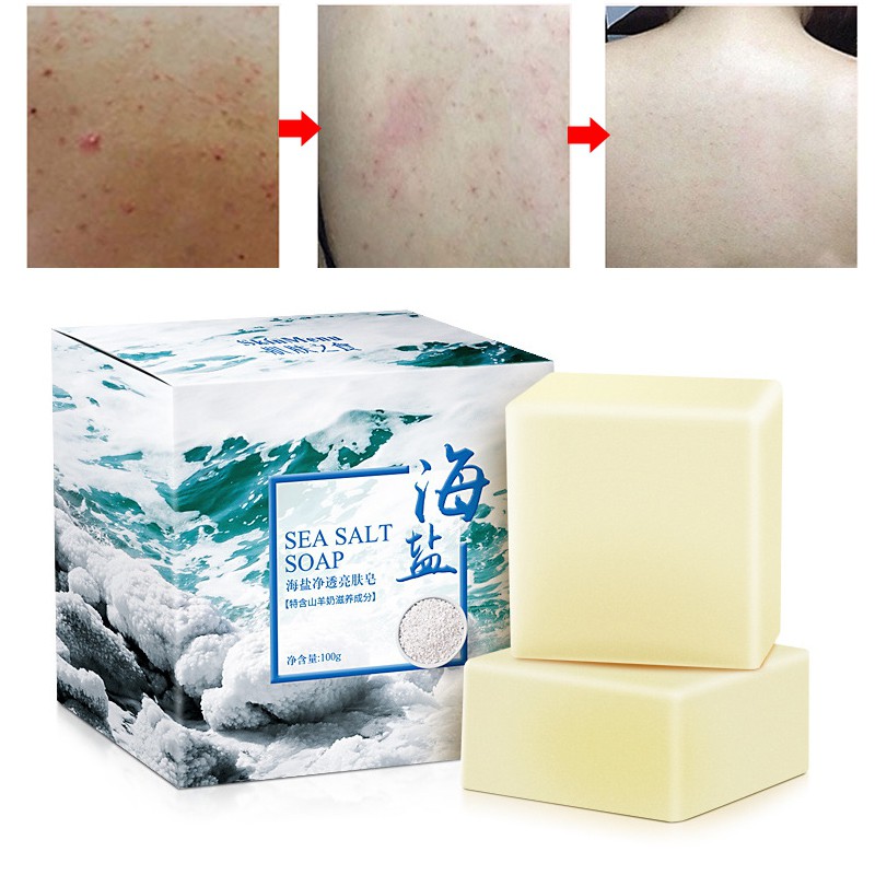Mite Soap Rich In Sea Salt Quickly Remove Mites Repair Nourish Skin ...