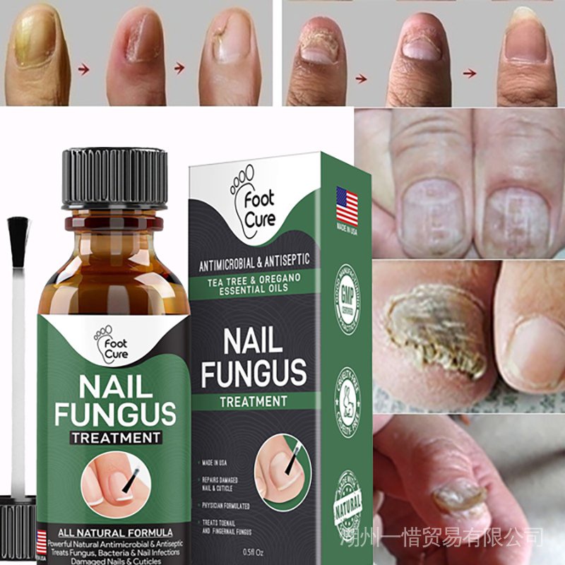 本地现货！当天可发！！Extra Strong nail fungus treatment, best nail repair, stop ...