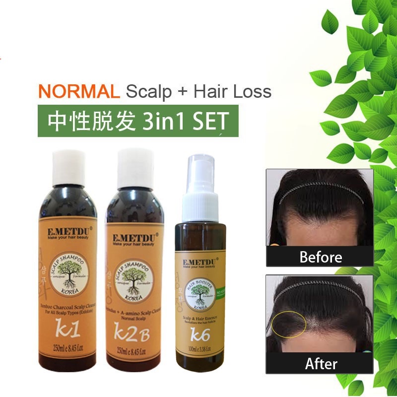 E.METDU【Normal Scalp + Hair Loss Package】3pcs Package丨Rambut gugur ...