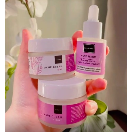 MALAYSIA READY STOCK Scarlett Whitening Cream Face Acne Variant Day ...