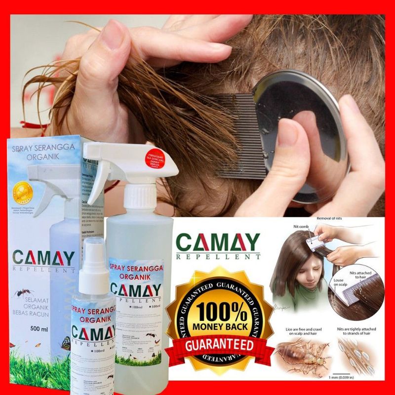 🔥 HOT SELLING 🔥 UBAT KUTU NATURAL / HEAD LICE CAMAY REPELLENT | Shopee ...