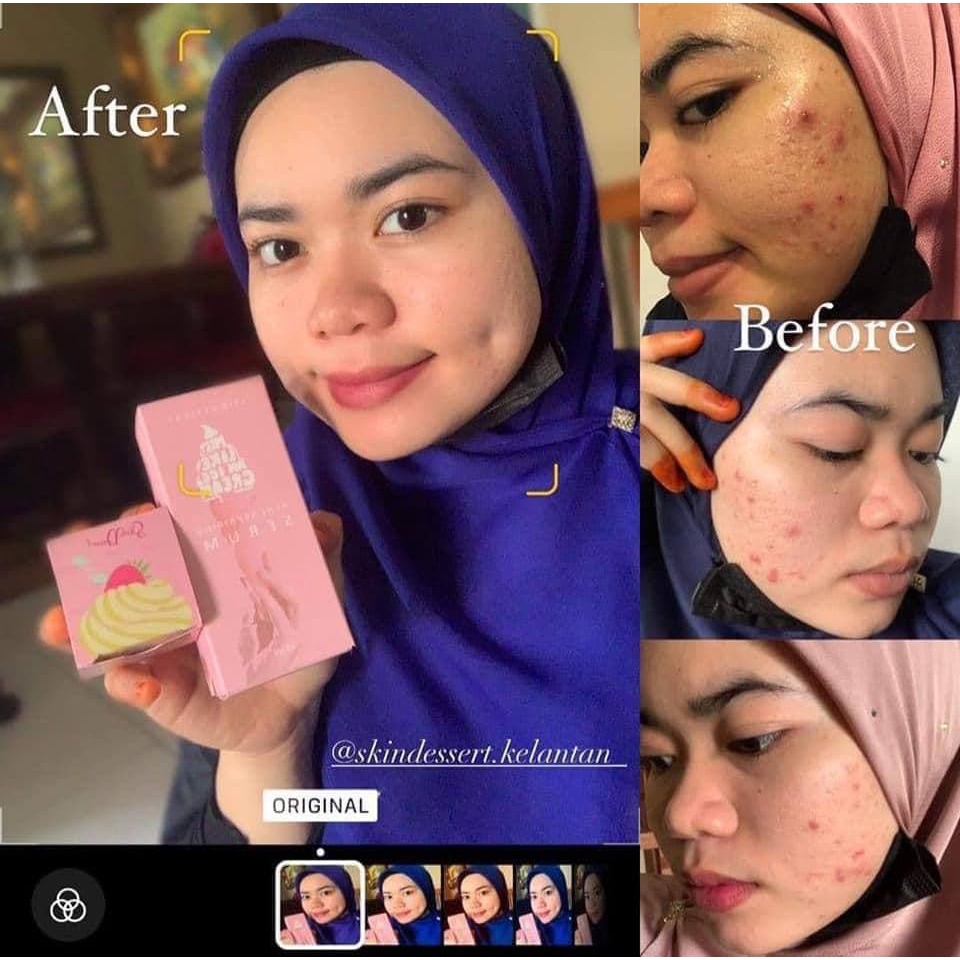 ORIGINAL 100 % SKIN DESSERT MOISTURIZER TREATMENT 5g/15 g READY STOCK ...