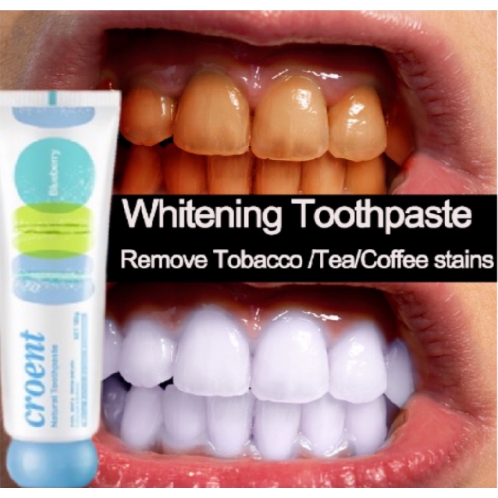 CROENT Toothpaste 100g Whitening Reduce Yellow Teeth Remove Tartar ...