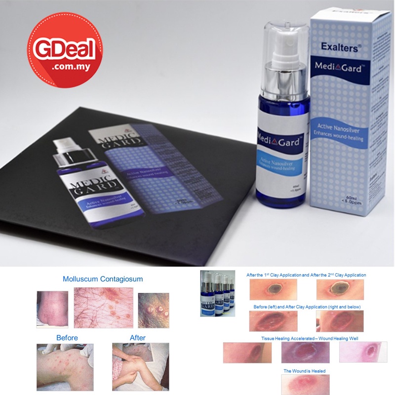 GDeal Medi Gard Exalters 60ml Active Nanosilver Enchances Wound-Healing ...