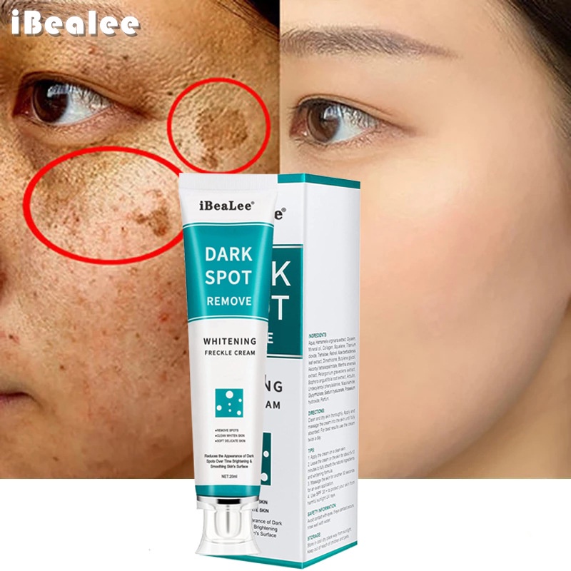 iBeaLee Whitening and freckle removing cream 20g Fade color spots mild ...