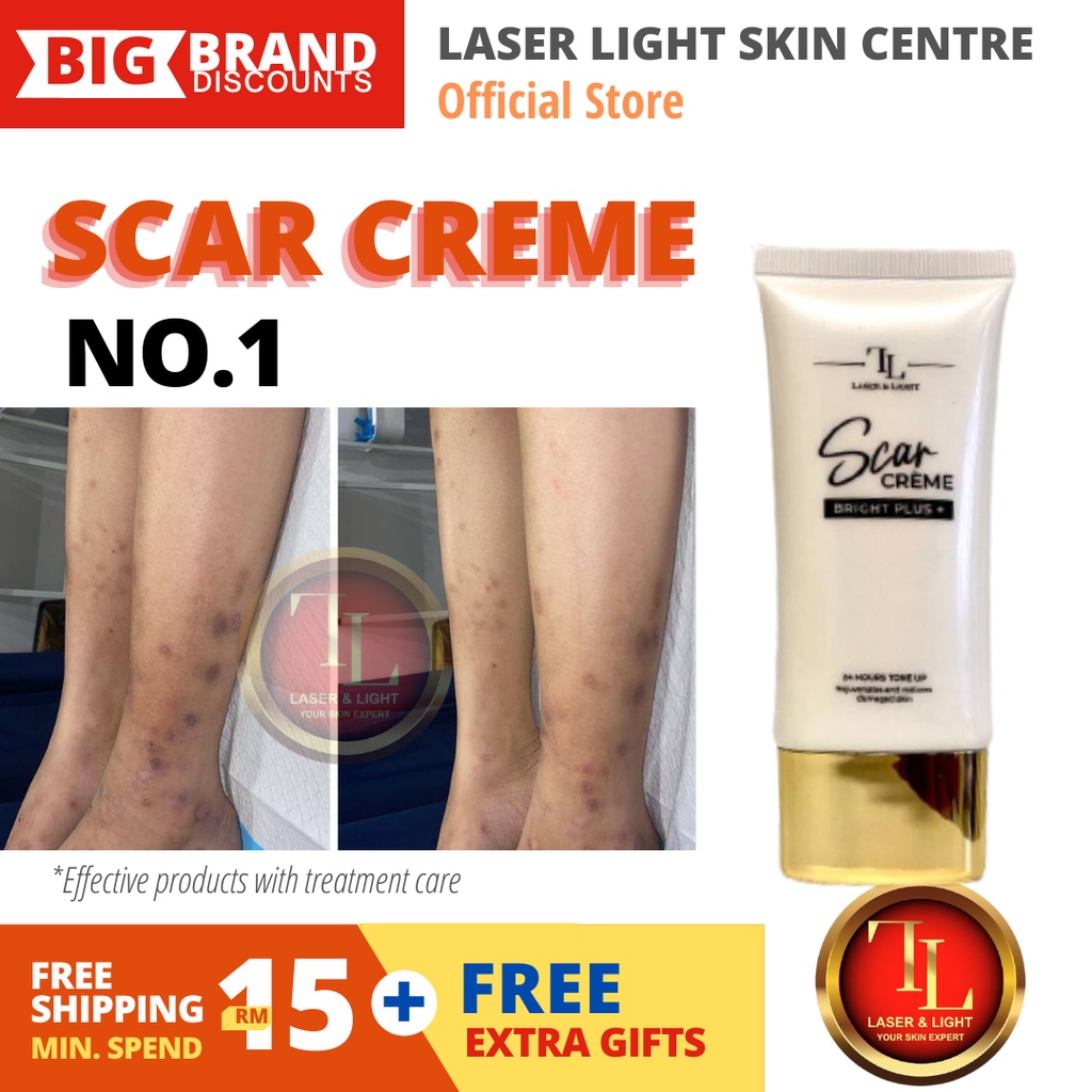 BRIGHT PLUS Scar Whitening Cream Original Krim Parut Kaki Hilang Parut ...