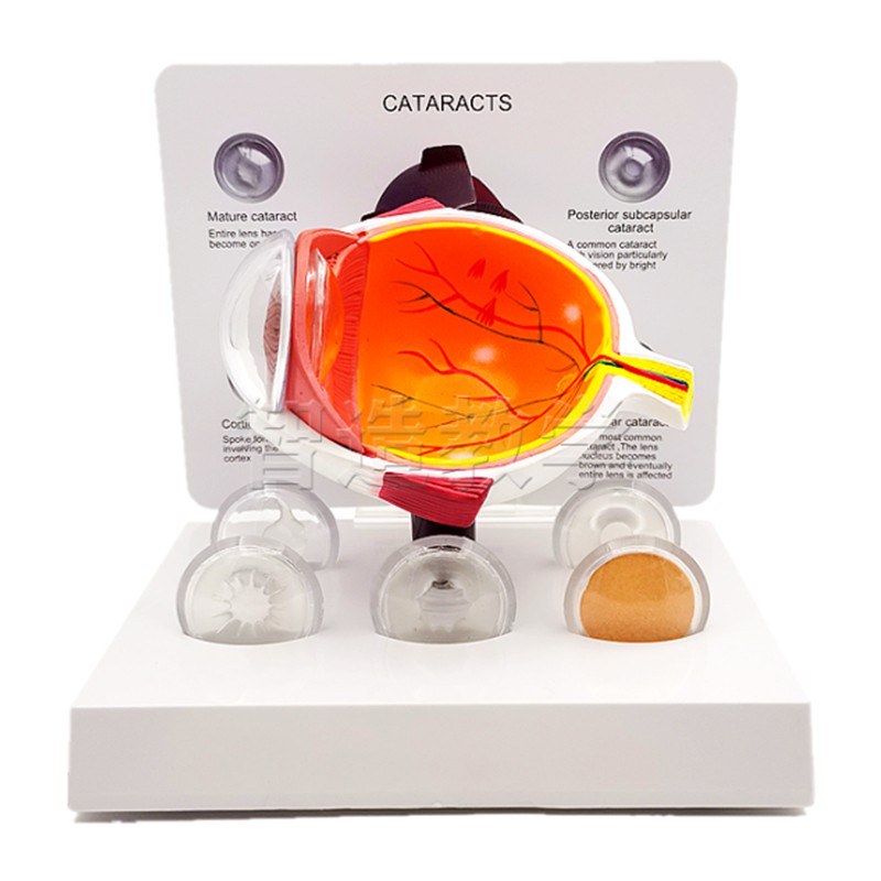 4 times Human PVC Eye Cataract Anatomy Medical Teaching Demonstration ...