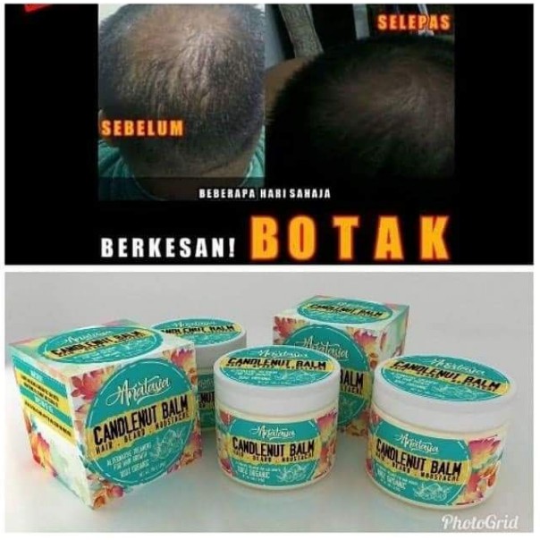 📢💥 PELEBAT RAMBUT JAMBANG MISAI - ANATASIA 💥 📢 SHOCKING SALE 🔥 | Shopee ...