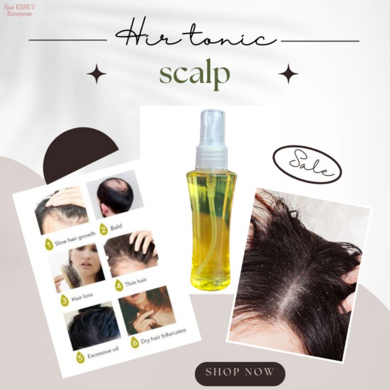 Borong Pelebat rambut Hair Toner/ Hair Tonic(Masalah Kelemumur/Kulit ...