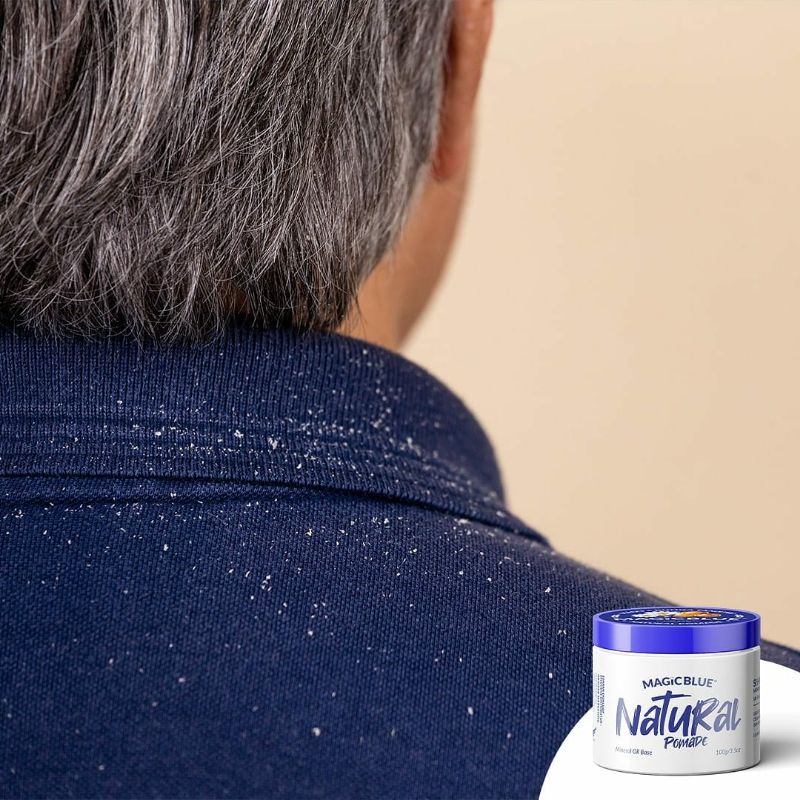 NATURAL POMADE MAGICBLUE KELEMUMUR PSORIASIS ANTI DANDRUFF RAMBUT LEBAT ...