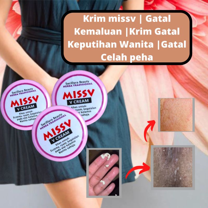 💥SHIP 24 HOURS💥KRIM MissV HILANGKAN Gatal Keputihan 🔥GATAL WANITA 🔥 ...
