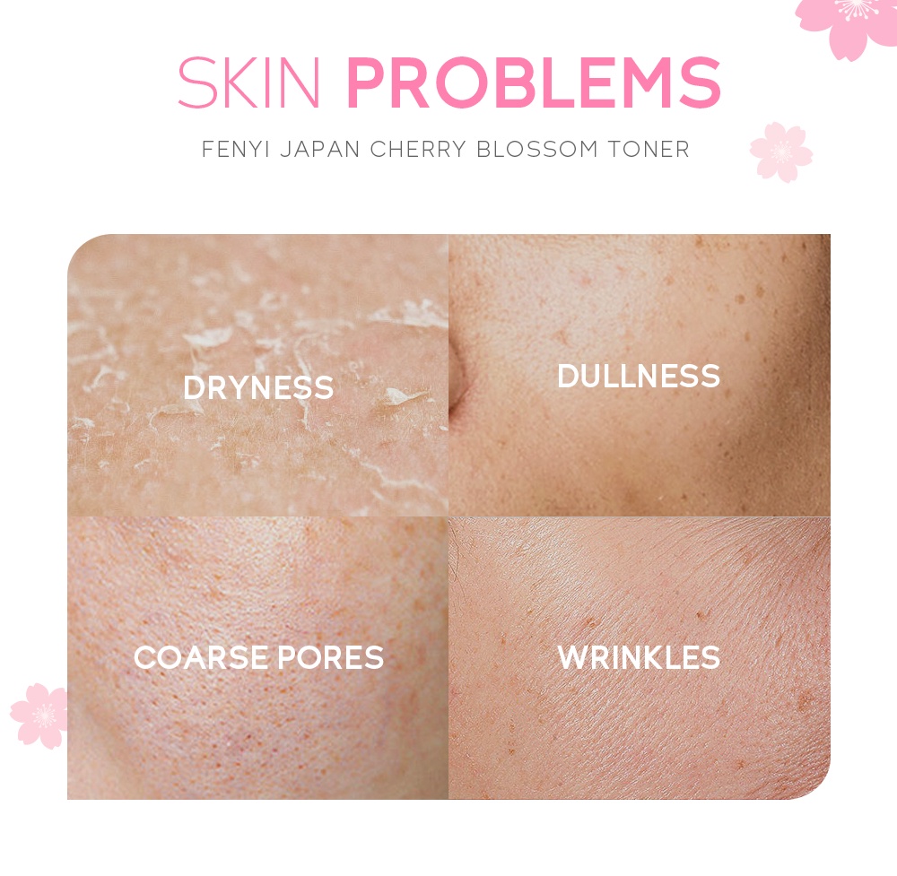 Fenyi Japan Cherry Blossom Toner Moisturizing Brighten Skin Tone ...