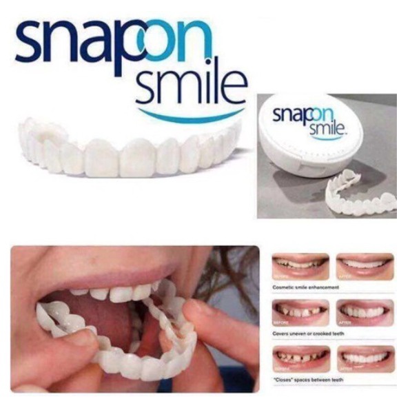 Pay ON The Spot] 100% ORIGINAL SNAP ON SMILE A Pair Of SILICON Dentures ...