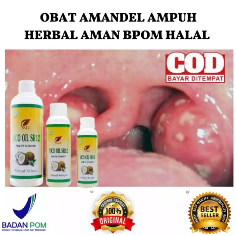 The most effective tonsils medicine, children's tonsils medicine ...