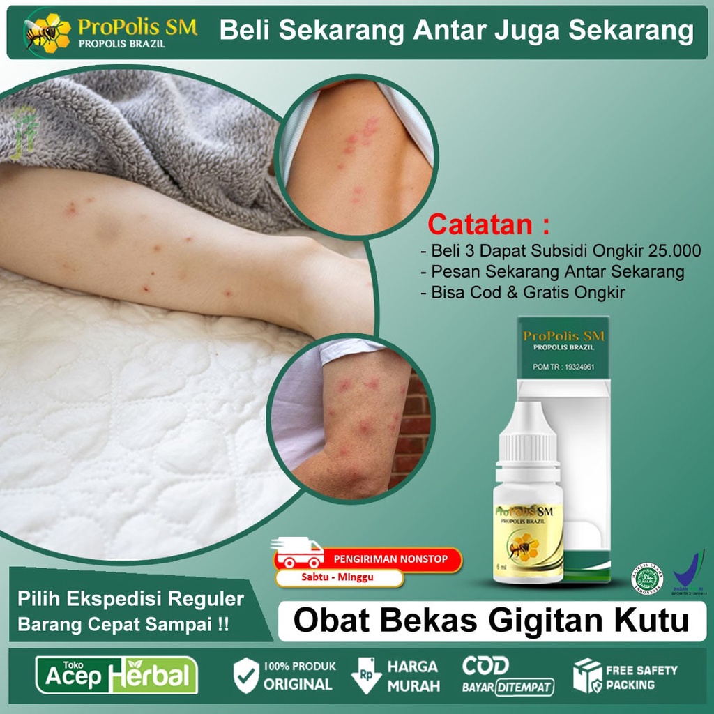 Medicine For Wounds Bite Skin Disease Allergic Skin Disease Fungus ...