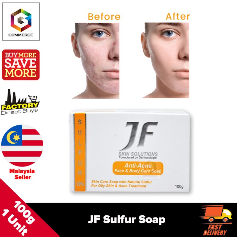 JF Sulfur Soap Sulphur for Oily Skin And Acne | Shopee Malaysia