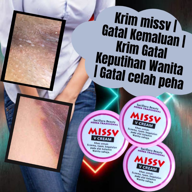 Ready stock 🔥KRIM MissV HILANGKAN Gatal Keputihan🔥GATAL WANITA 🔥Eczema ...