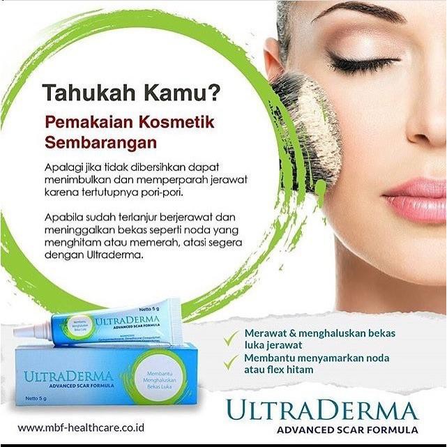 Ultraderma Advance Scar Formula Overcome Scars And Acne Scars 5g ...