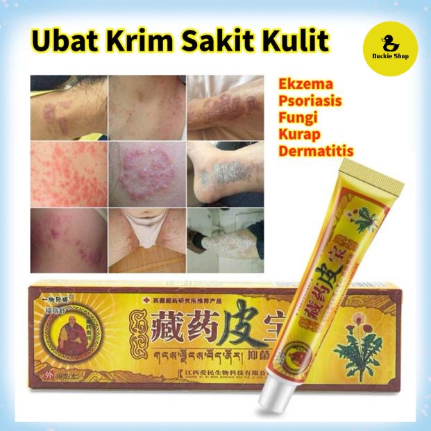 Duckie-Krim Kurap Gatal Ekzema Psoriasis Pure Chinese Herbs Eczema ...