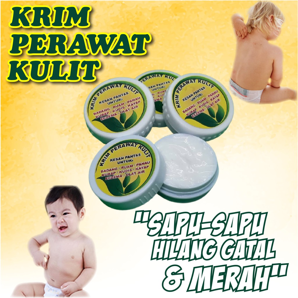 Krim gatal Mujarab Krim Gatal/ Ezcema/ Psoriasis/ Kurap/ Ruam | Shopee ...