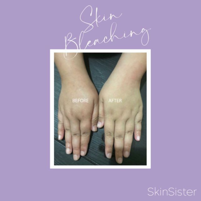 3 in 1 100ml Skin bleaching (putih seawal 10minit) | Shopee Malaysia