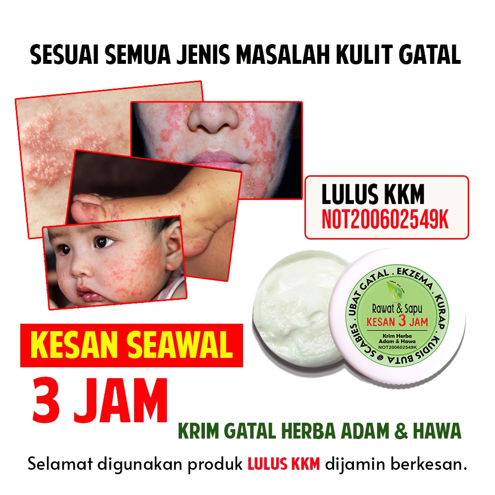 Ubat gatal mujarab dan tidak panas, krim gatal kulit baby, cream kulit ...