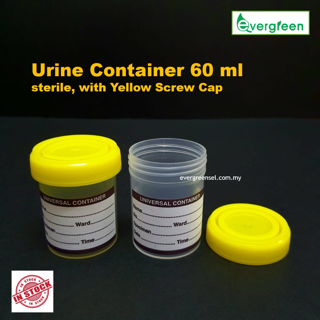 Specimen Container (Urine Container / Universal Container ) 60 ml with ...