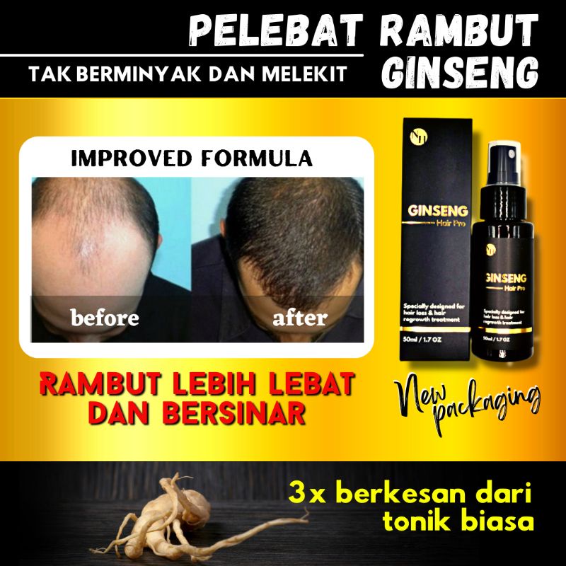 Hair growth serum Tonic ginseng melebatkan rambut Hair thickener anti ...