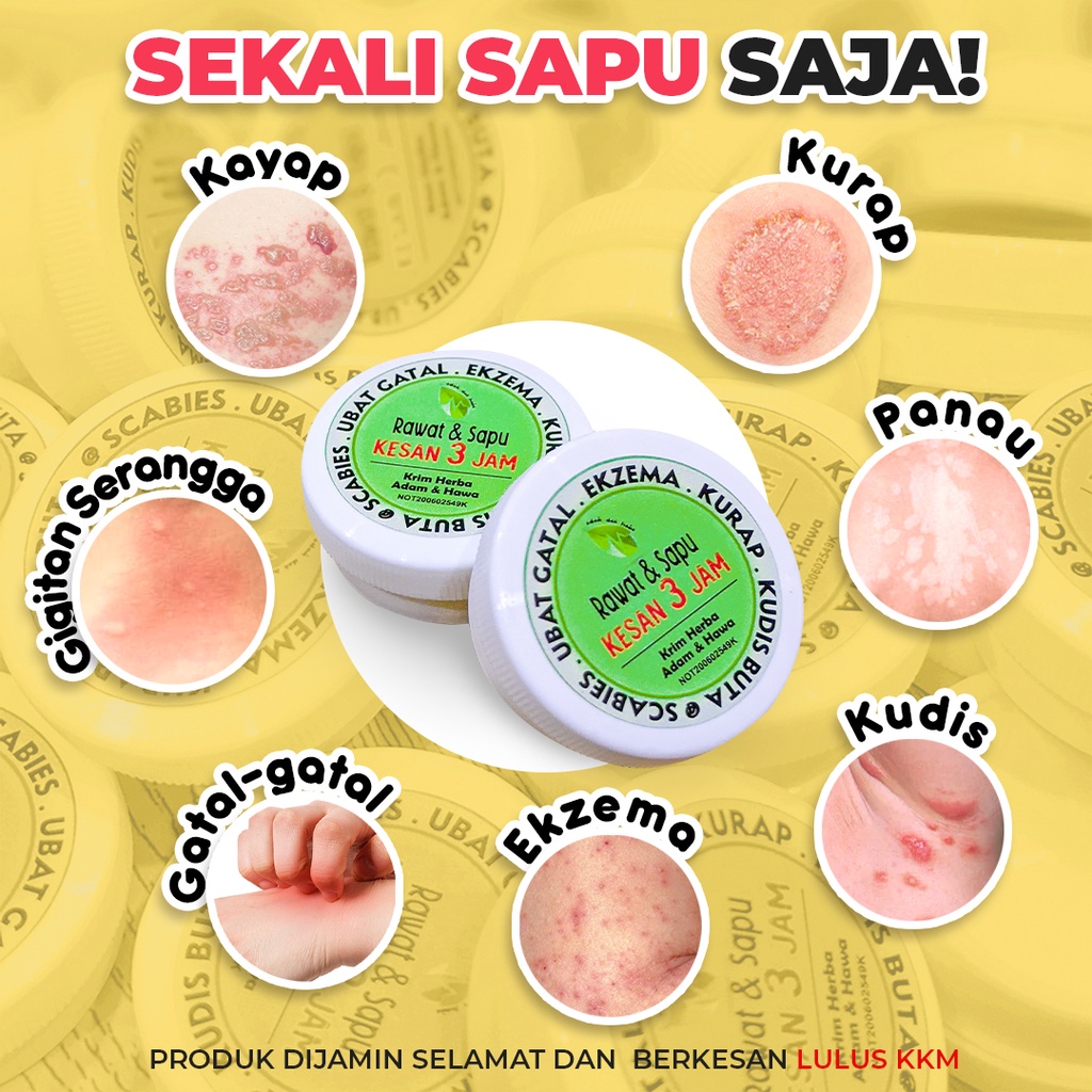 Eczema Cream Krim Gatal Kulit Ubat Panau Ubat Kurap Ubat Gatal ...