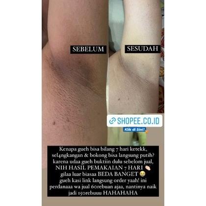 Celo Premium Skin Whitening || Asendo | Shopee Malaysia