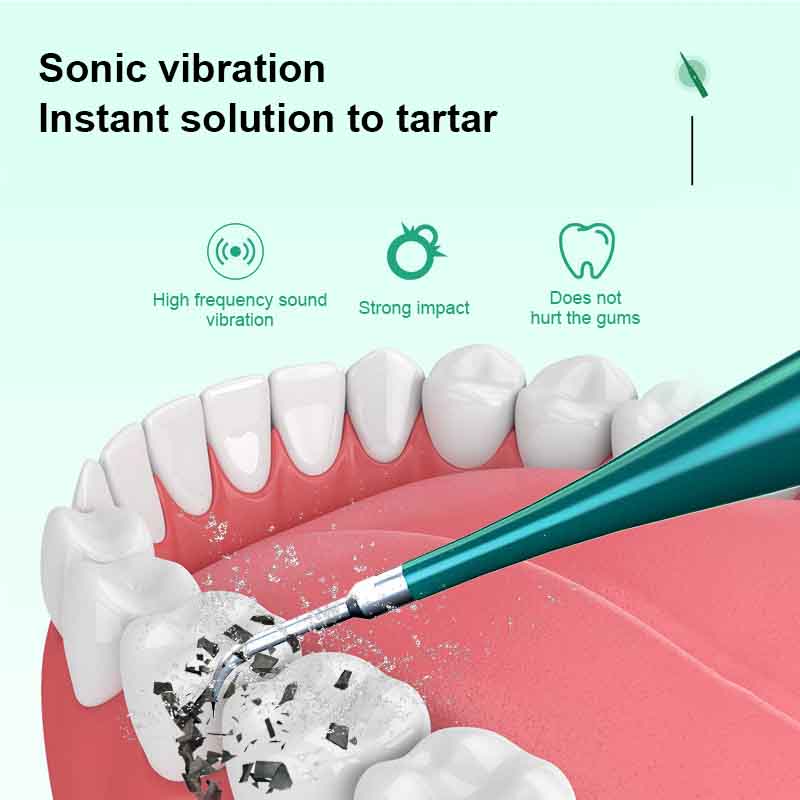 Ultrasonic Sonic Dental Scaler USB Electric Vibration Toothbrush for ...