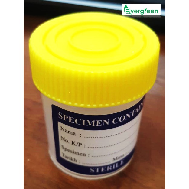 ( BM Version ) Urine Container / Universal Container, 60 ml with Yellow ...