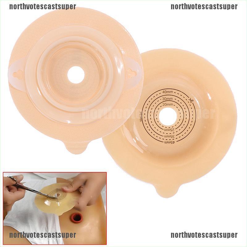 Northvotescastsuper Base Plate Two-piece System Ostomy Bag Baseplates ...