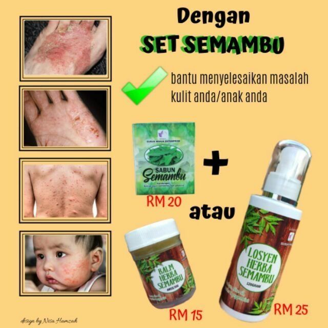 🔥READY STOCK 🔥Set semambu / sabun semambu / losyen semambu/ balm ...