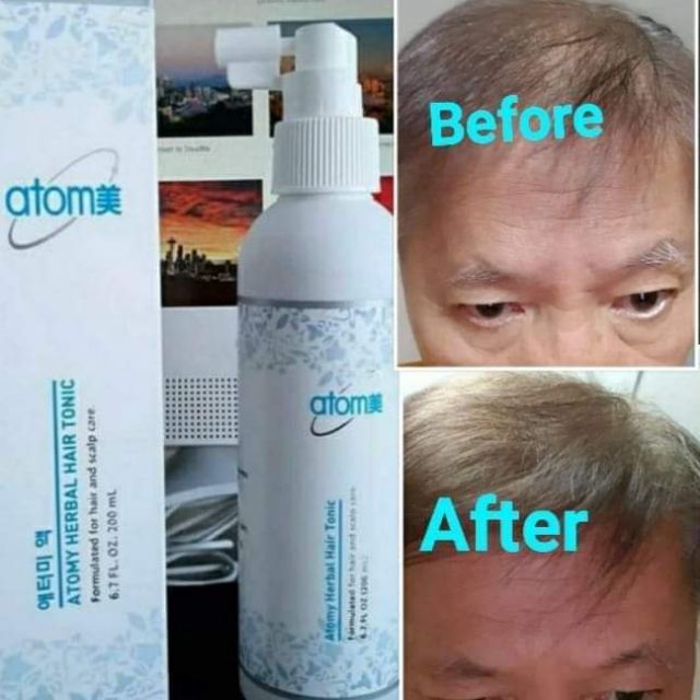 🌿Atomy Hair Tonic 200ml 🌿 Rahsia Penjagaan Rambut 🌟🌟 | Shopee Malaysia