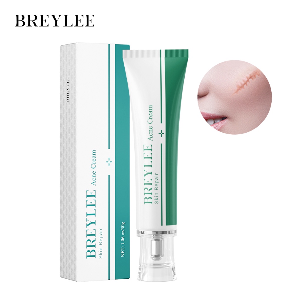 BREYLEE Acne Scar Removal Gel Skin Repair Scar Acne Treatment Remove Stretch Marks Whitening 30g ...