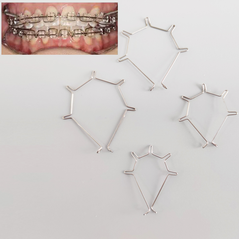 10Pcs/Pack Dental Orthodontic Five Curved Torque Spring Auxiliary Arch ...