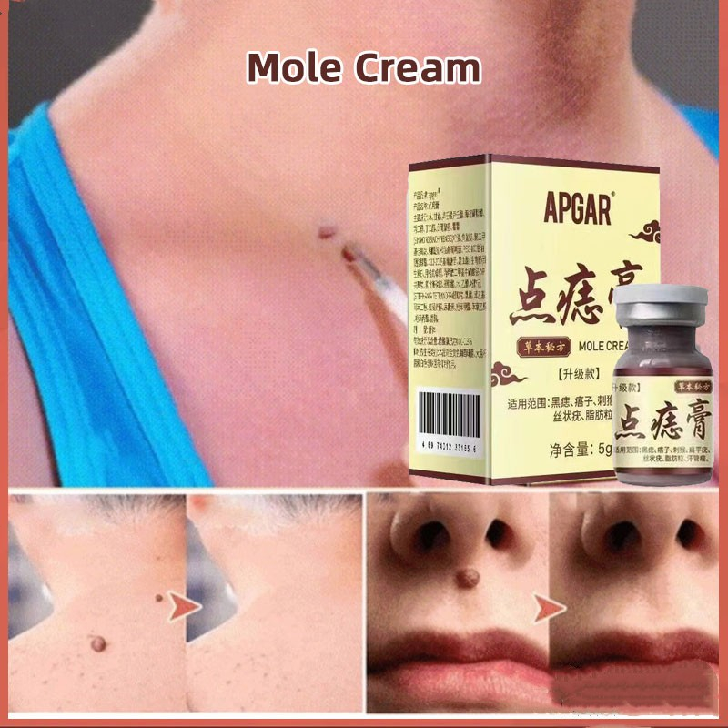 APGAR Concentrated Potent Skin Tag Removal Cream Body Warts Cream Spot ...