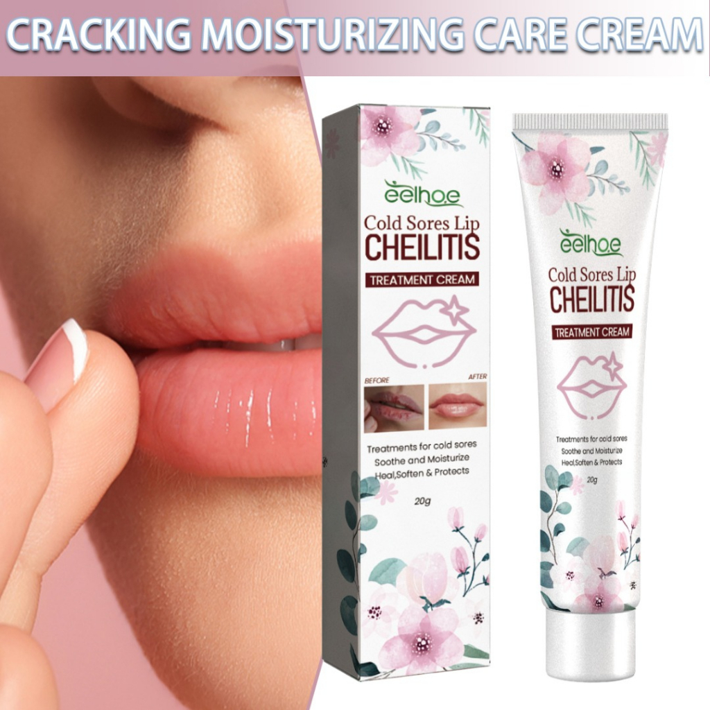 Cold Sores Lip Cheilitis Treatment Cream for Dry Chapped Peeling Cracked Lips | Shopee Malaysia