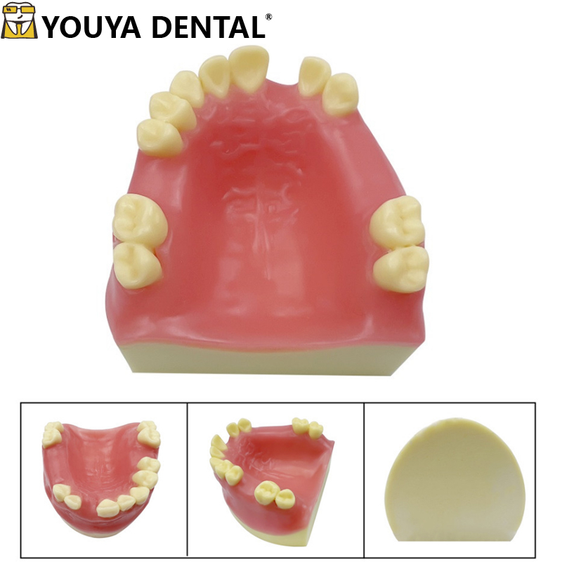 Implant Teeth Model Practice Dentist Dental Students Training Studying ...