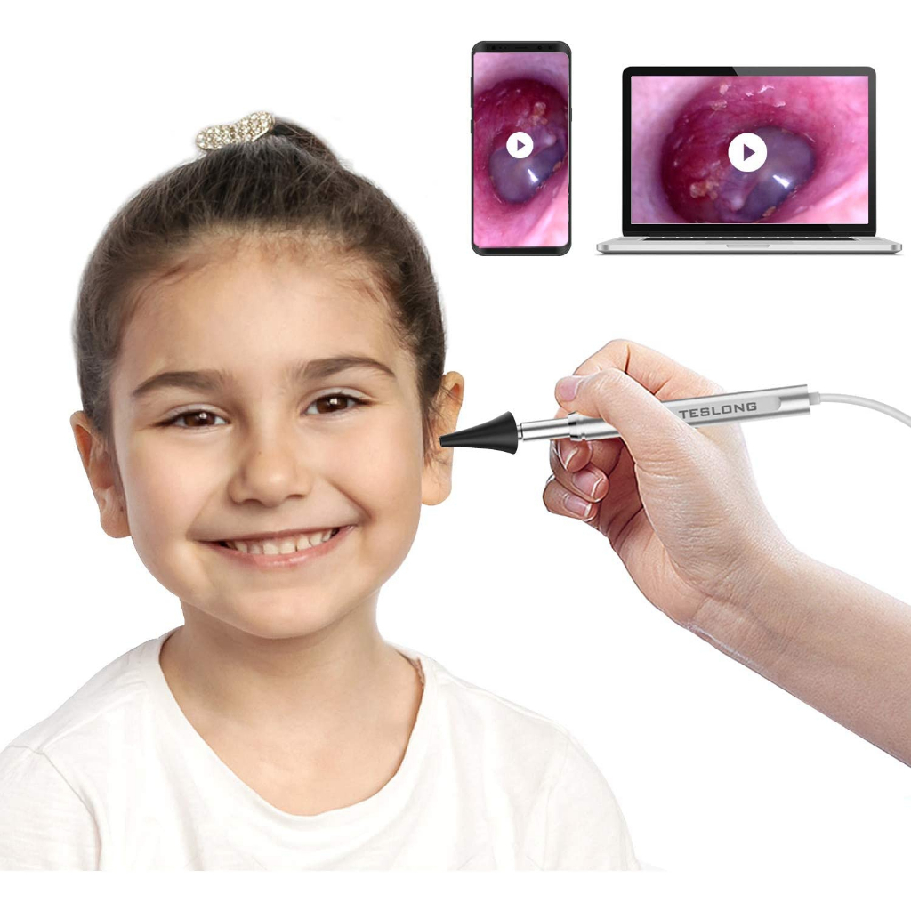 Teslong Ultra-Slim Digital Otoscope, New Upgrade 4.3mm Diameter Visual ...