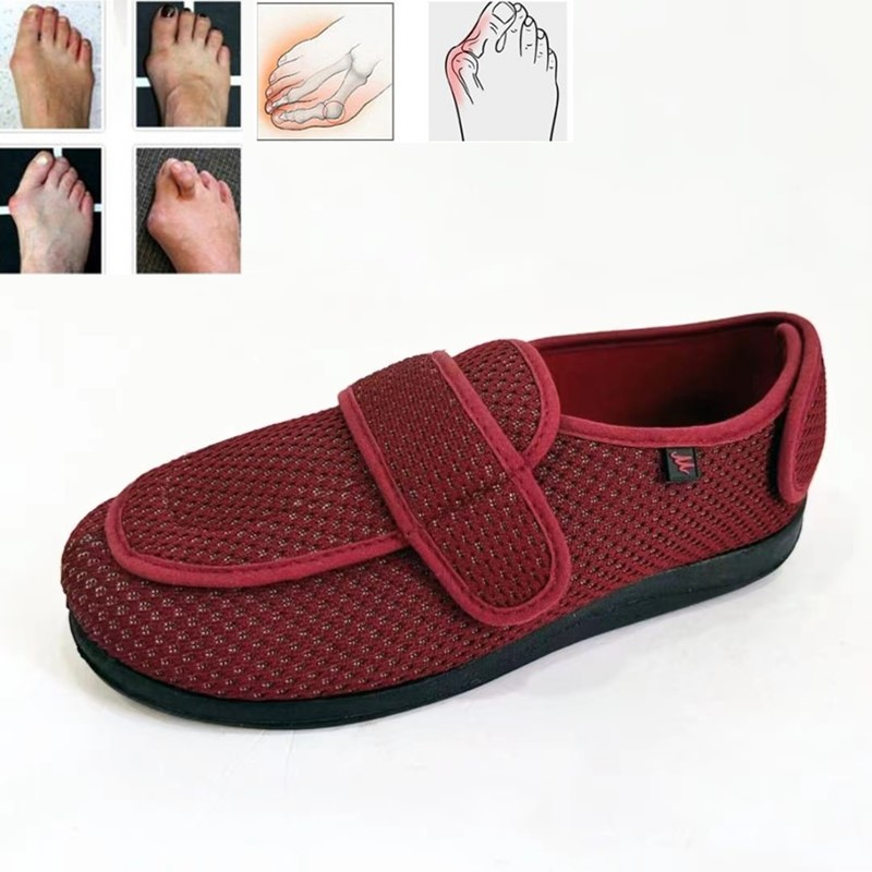 Spring and summer diabetes foot postoperative foot swelling shoes ...