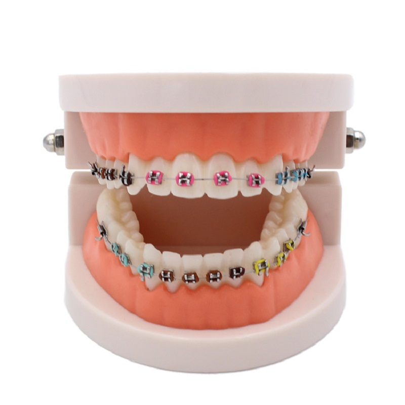 Dental Orthodontic Teach Study Tooth Teeth Model with Metal Brackets ...