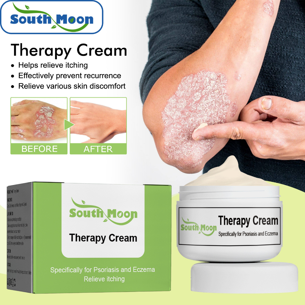South Moon Psoriasis Treatment Cream 20g Anti-itch Rash Urticaria ...