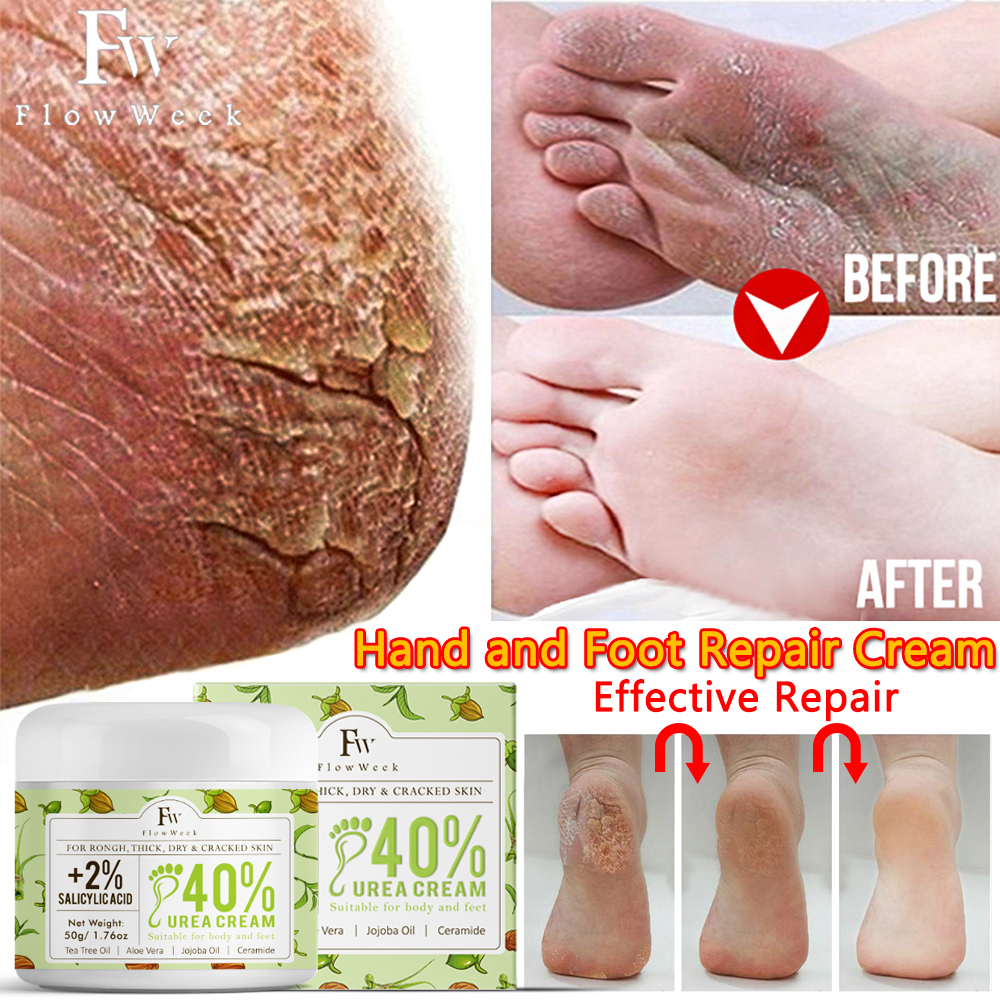 Flow Week Urea Cream Hand Foot Cream Callus Remover Salicylic Acid ...