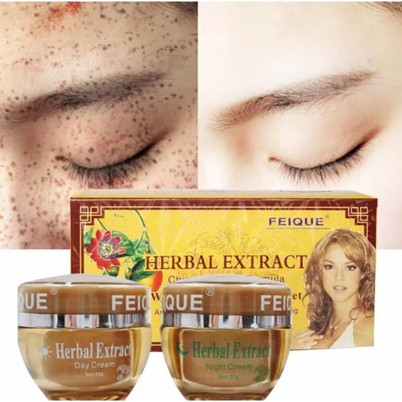 FEIQUE 2 in1 Anti Freckles Whitening Cream Remove Freckle Speckles Dark ...