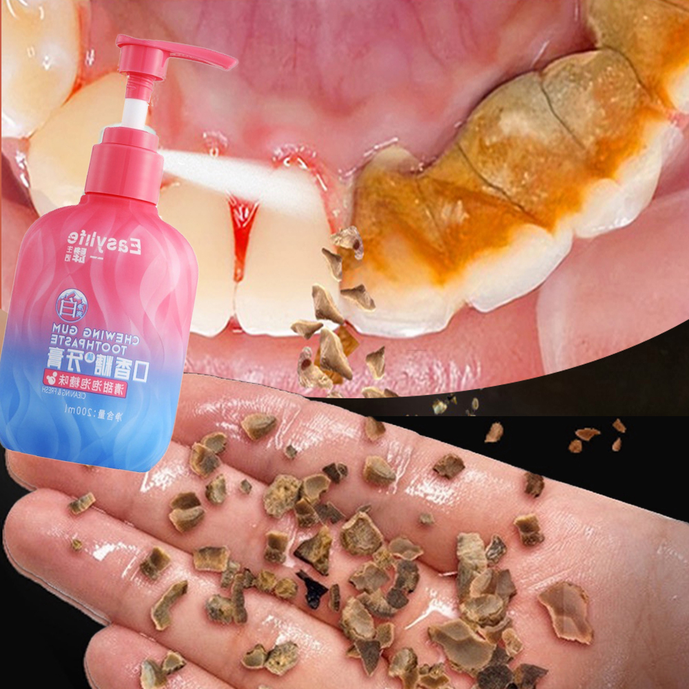 【Ready stock】whitening yellow teeth teeth whitening chewing gum ...