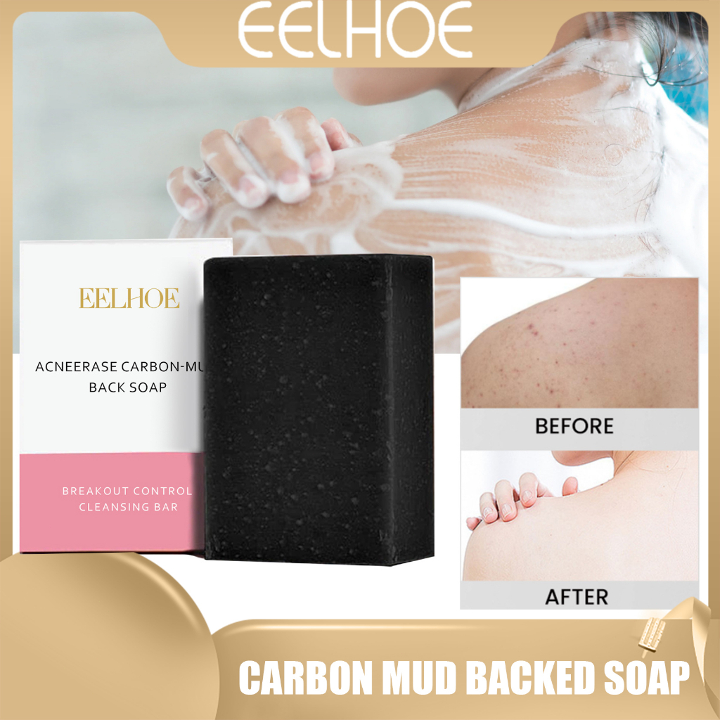Eelhoe Acne Removing Soap Volcanic Mud For Dark Spot, Oil Control ...